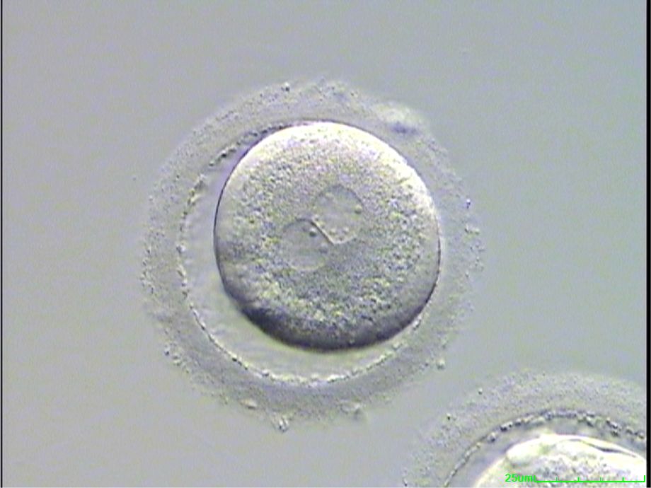 A Beginner’s Guide to IVF