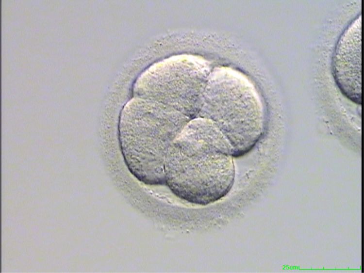 A Beginner’s Guide to IVF