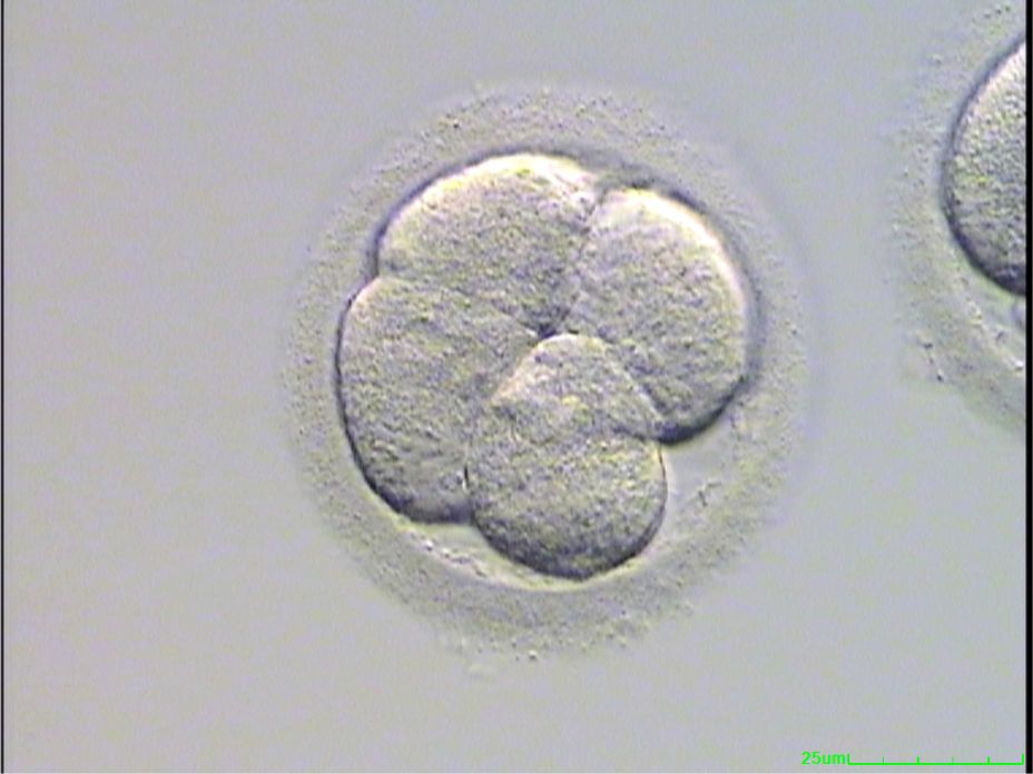 A Beginner’s Guide to IVF